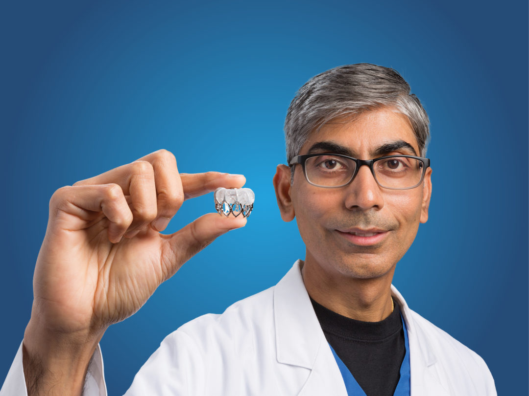 Watchman Device Shreveport | AFib Stroke Prevention