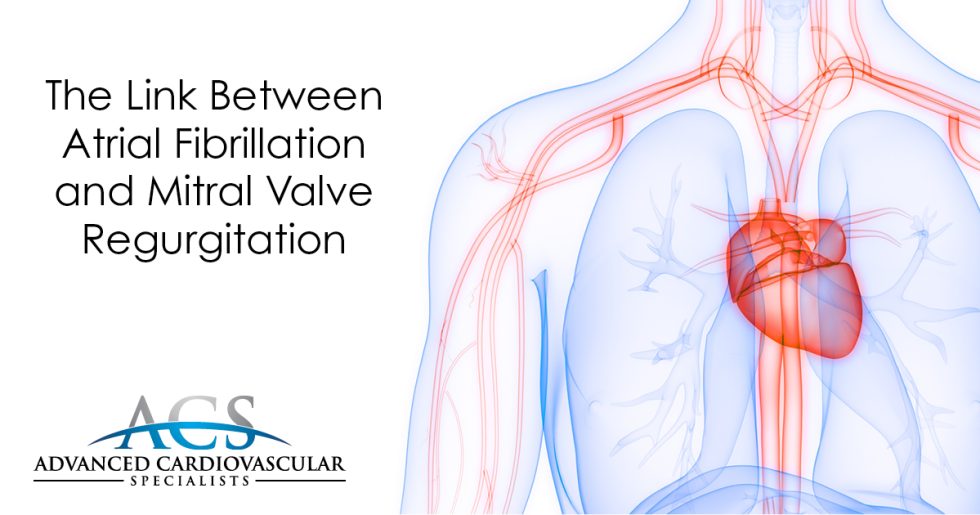 Atrial Fibrillation And Mitral Valve Regurgitation: Are They Connected ...